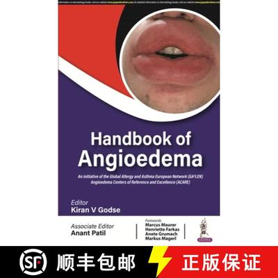 【3-4周达】Handbook of Angioedema [9789356961647]