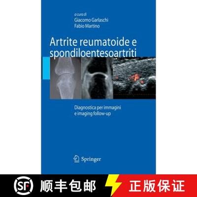 【3-4周达】Artrite reumatoide e spondiloentesoartriti : Diagnostica per immagini ed imaging follow-up [9788847006850]