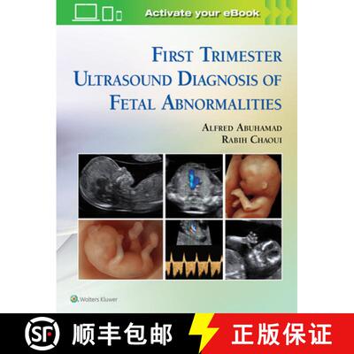 【3-4周达】精装 First Trimester Ultrasound Diagnosis of Fetal Abnormalities [9781451193725]