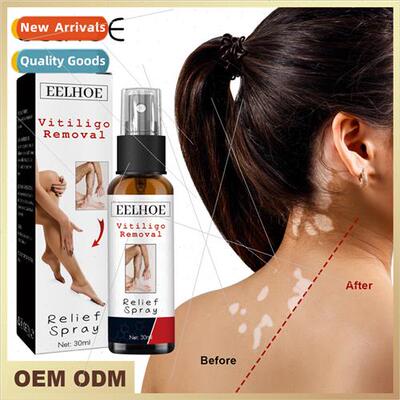 White  Repair Spray Repair and lighten white spots flower sp