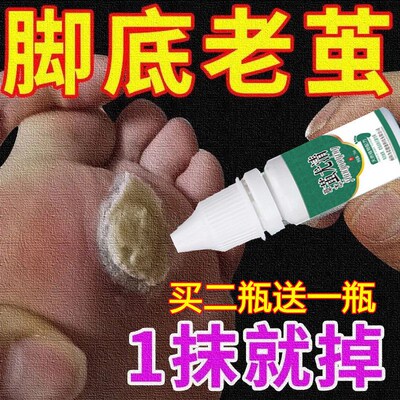 祛脚茧脚底老茧手茧祛除茧子膏专用神器死皮磨脚石神器手脚垫药