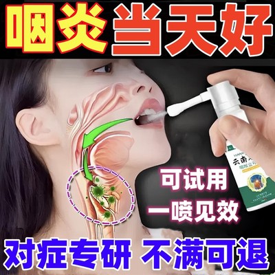 咽喉炎慢性咽炎除根贴治疗咙异物感痒滤泡增生润喉糖神器特效喷剂