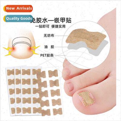 Glue-free orthodontic nail stickers toenail ingrown toenail