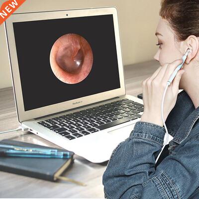 n Ear Cleanng Endoscope SB Vsual Ear Spoon 5.5mm 0.3MP M