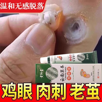 【药房同售】鸡眼膏官方旗舰店