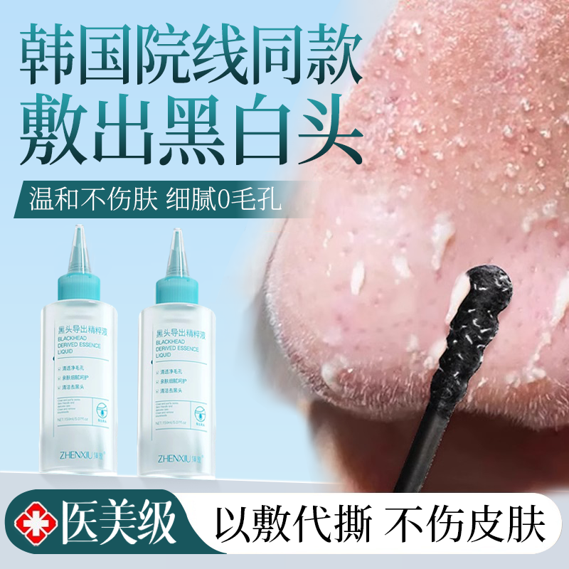 黑头导出液木瓜蛋白酶去黑头美容院专用和收缩毛孔黑头水粉刺神器