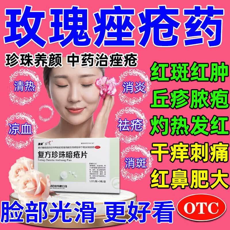 复方珍珠暗疮片清热皮脂汗腺中药祛痘痤疮内服粉刺闭口清热解毒