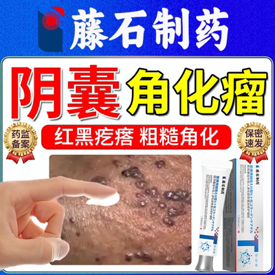 藤石制药】阴囊角化血管瘤修复膏