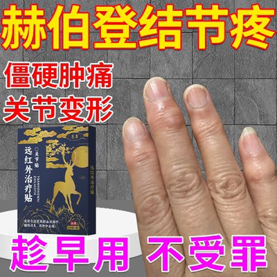 赫伯登结节手指变形僵硬疼痛贴