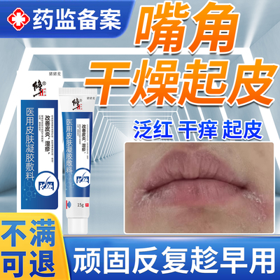 【现货速发】嘴角干燥起皮泛红