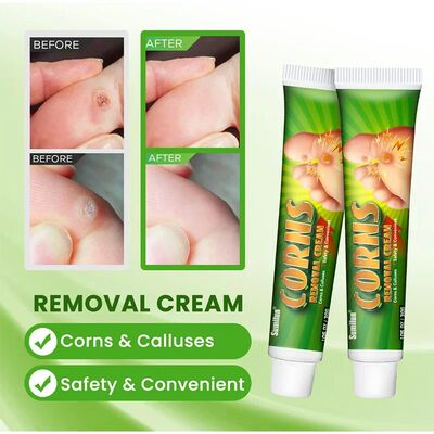 Foot Corn Remover Cream Chicken Eye Skin Infection atment Oi