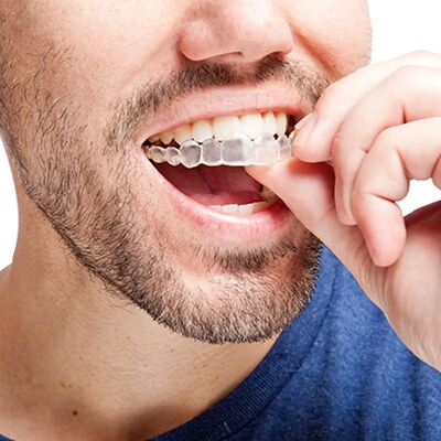Invisalign-bandejas de termoformado para higiene Dental, ins