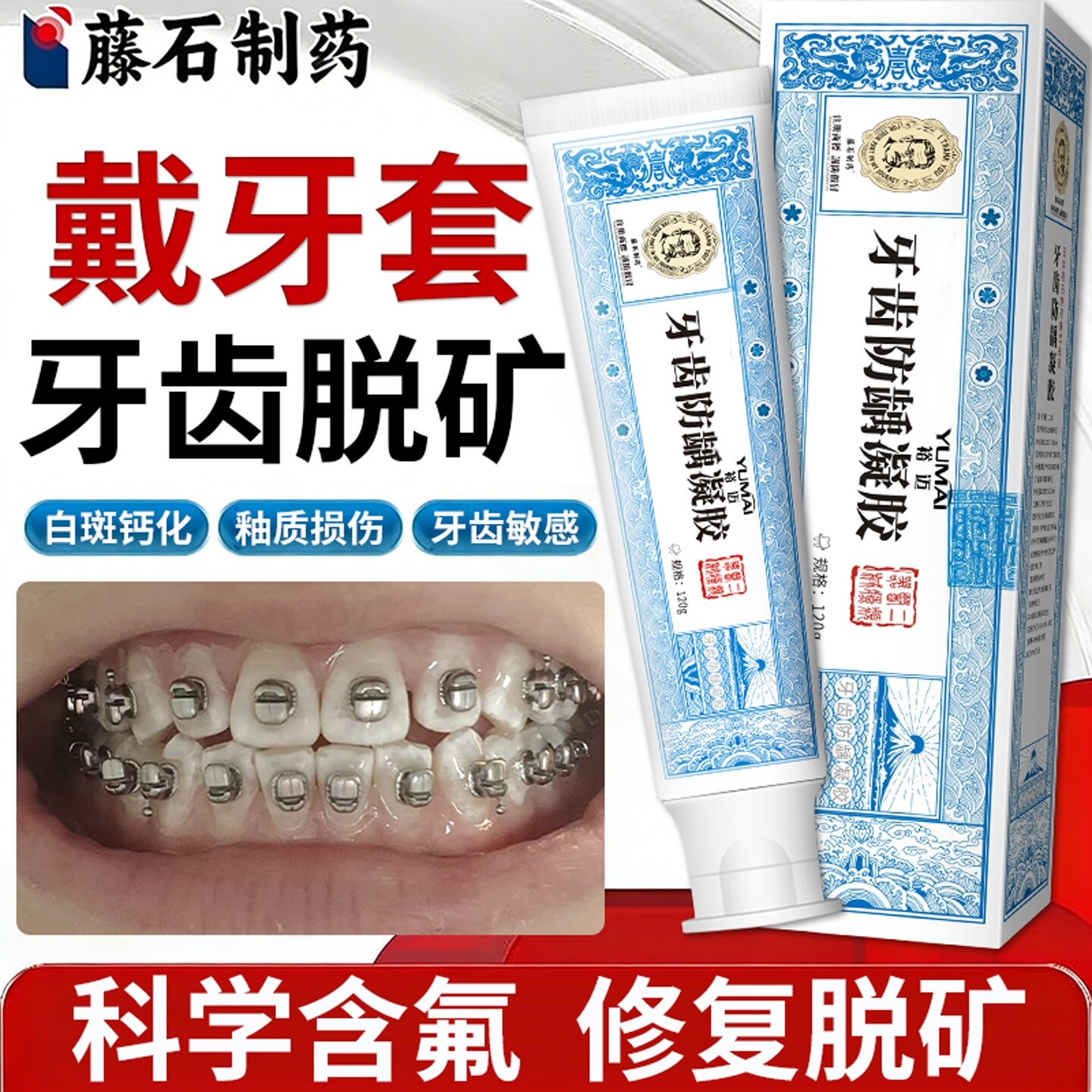 青少年儿童戴牙套牙齿脱矿专用牙膏修复防脱矿含氟再矿化护牙素KD