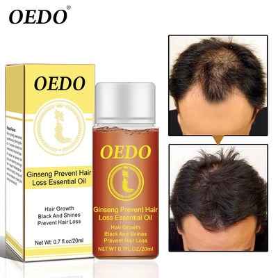 Ginseng Hair Growth Essence Preventing Hair Loss Liquid oil