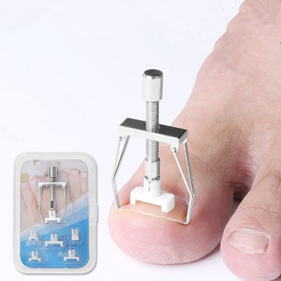 New Ingrown Toe Nail Fixer Pedicure Recover Embed Toenail Co