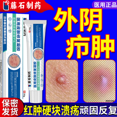外阴火疖子私处疖肿搭拔毒拔脓药膏屁股长痘皮脂腺囊肿毛囊硬块QN