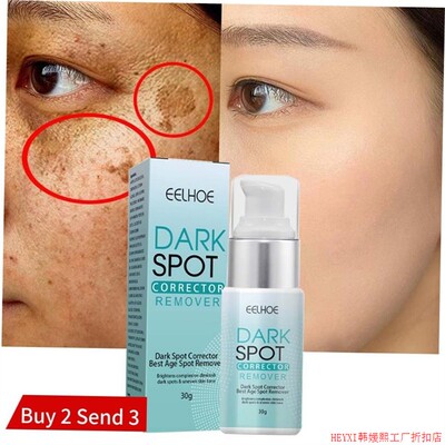 Nicotinamide Whitening Freckle Cream Dark Spot Remover Skin
