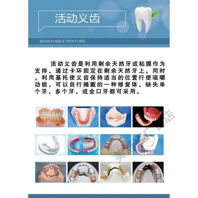 牙科口腔诊所知识宣传画烤瓷牙活动义齿隐形义齿精密附件墙贴画