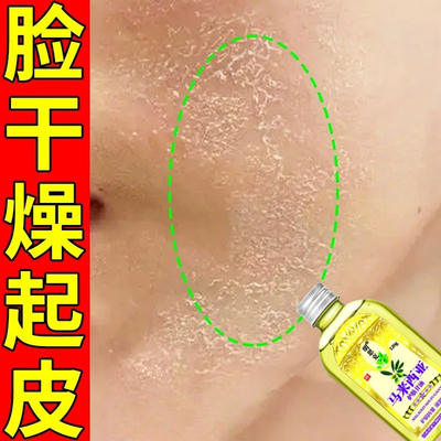 脸干燥起皮嘴角有碎屑脱皮泛红脸上皮肤长癣瘙痒过敏滋润修复甘油