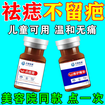 点痣药水不留疤【美容院专用