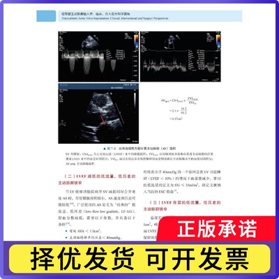 经导管主动脉瓣植入术：临床、介入及外科学视角：interventional and surgical perspectives[意] Arturo Giordano9787504695222