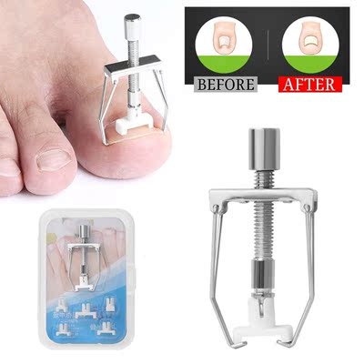 Ingrown Toe Nail Correction Lifter Pedicure Toenail Fixer Re