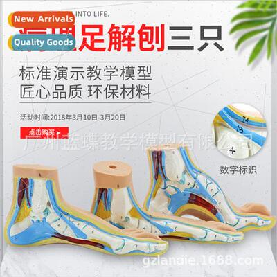 Normal foot flat foot arched foot model/arch model Anatomica