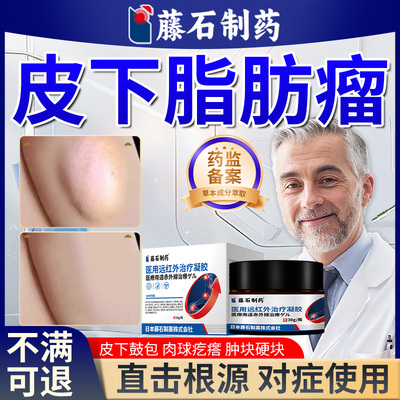 擦脂肪瘤膏肿硬块皮下去消膏除皮肤下纤维粉瘤皮脂腺囊肿膏神器xu