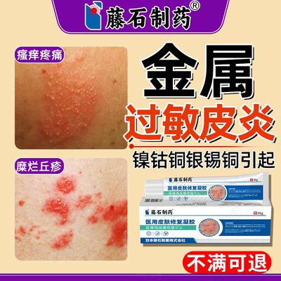 防皮肤金属过敏贴镍钴铜银锡铜瘙痒红斑接触性皮炎可搭膏药贴CS