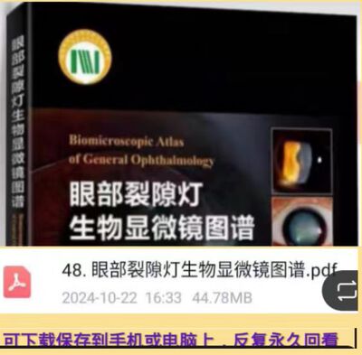 眼超声生物显微镜诊断学ubm图谱检查电子资料眼科ubm机器检查