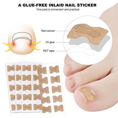 Ingrown Toenail Sticker Nail-Corrector Foot-Care Glue