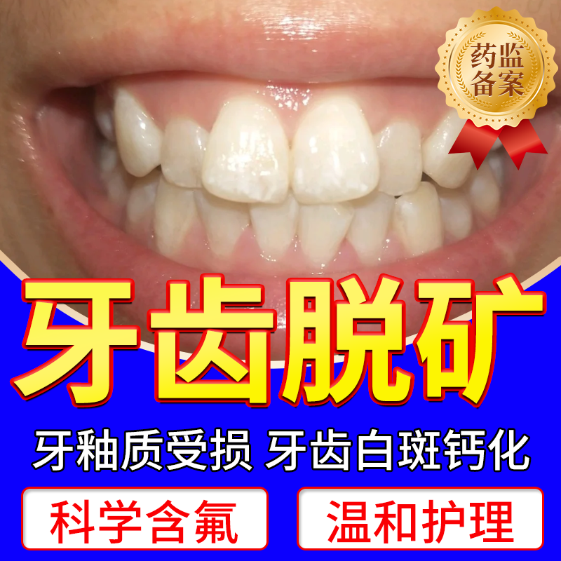 牙齿脱矿防白斑钙化再矿化护牙素修复含氟非牙膏专用牙釉质JW