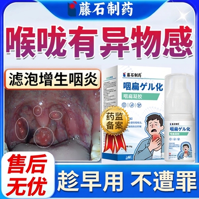 【医用级】喉咙有异物感喷剂