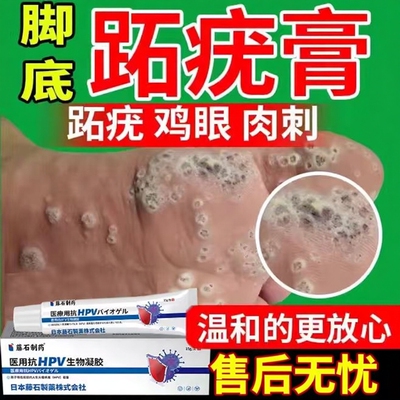 【医用级】脚底长跖疣石疣专用膏