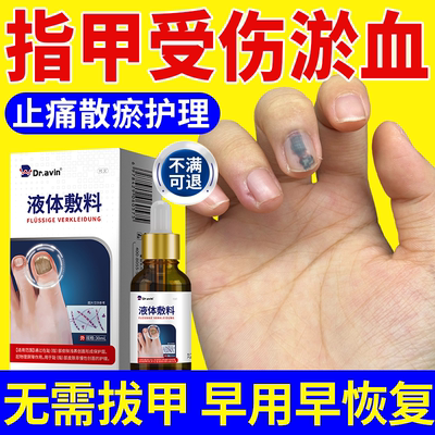 德国监制】指甲被夹被砸受伤淤血