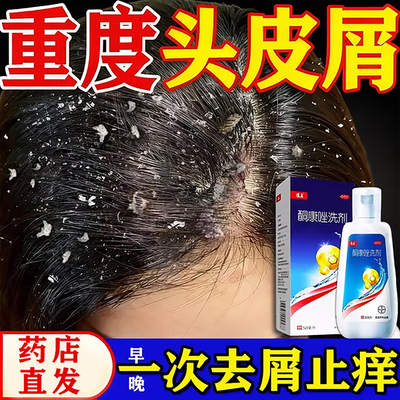 【康王】复方酮康唑发用洗剂0.025%1.5%*50ml*1瓶/盒