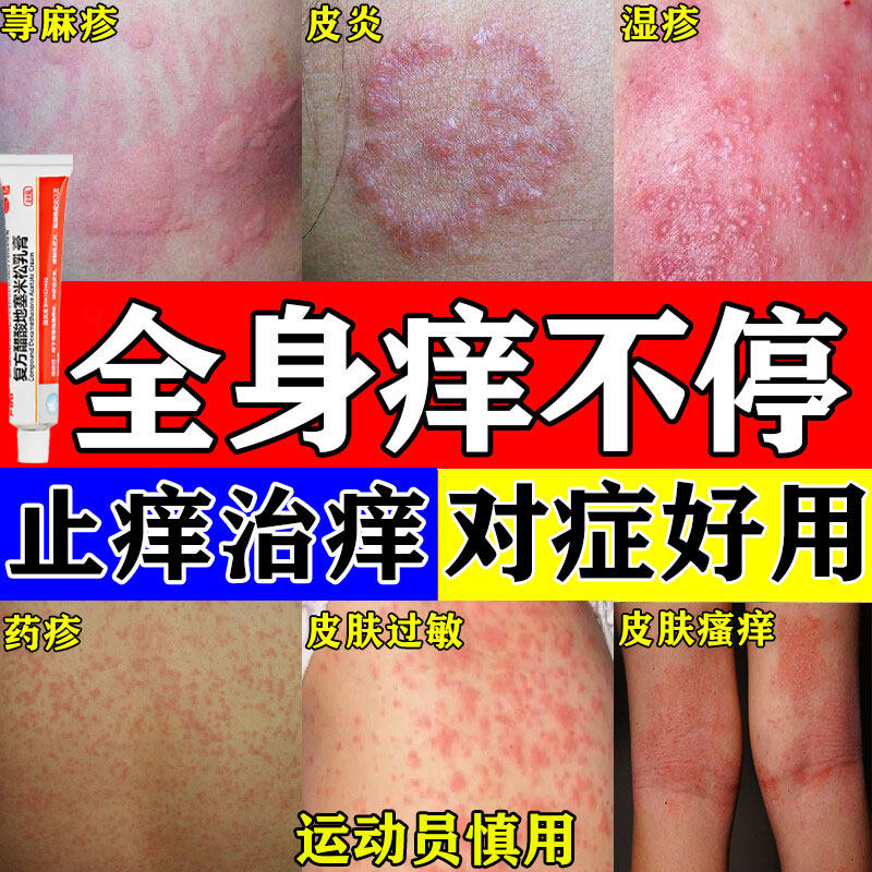 复方醋酸地塞米松乳膏湿疹皮炎止痒膏治神经脂溢性皮炎真菌感染
