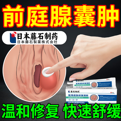【药监备案】前庭大腺巴氏腺囊