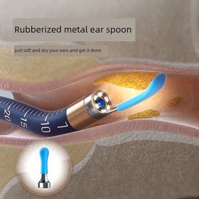 bebird智能视觉耳勺独家耳勺头配件[Bebird3Plus专用,而不是产品