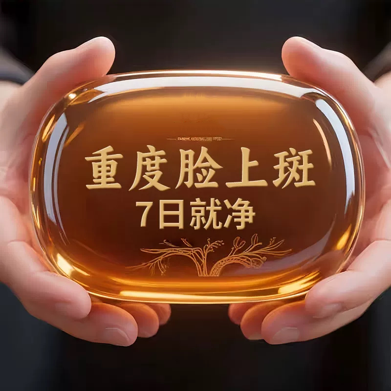【老香港热销红花皂】斑皂祛老年斑晒斑斑点黑色素男女士黄斑正品