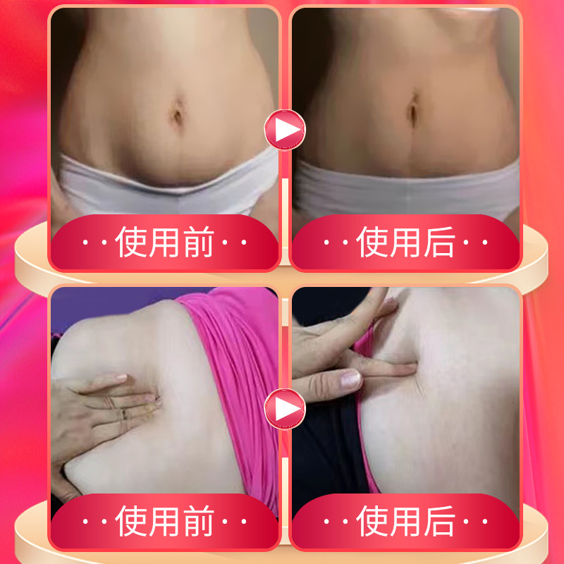 极速腹直肌分离修复贴产后收腹家用仪器训练锻炼器缩腹Y直肌阴大
