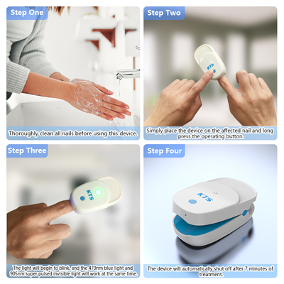 Fungal Nail Treatment Laser Device For Nail Fungus 905nm 470
