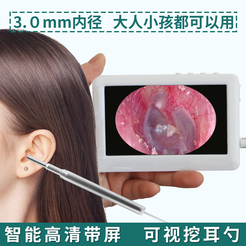好货可视挖耳勺高清掏耳朵神器采耳工具耳镜耳鼻喉内窥镜专业采耳