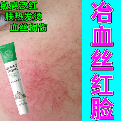 脸上的红血丝修复增厚角质层肌肤屏障受损修护脸红专用草本乳膏