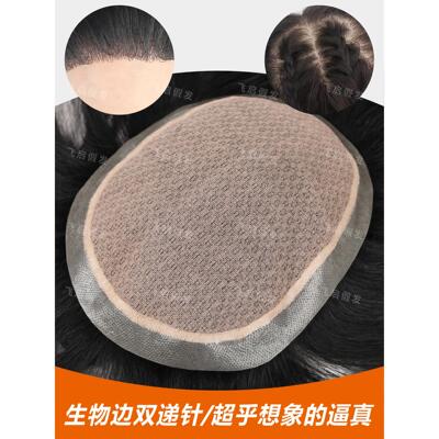 全递针真发假发男士超薄生物头皮无痕高端头顶补发片真人秃顶彷真