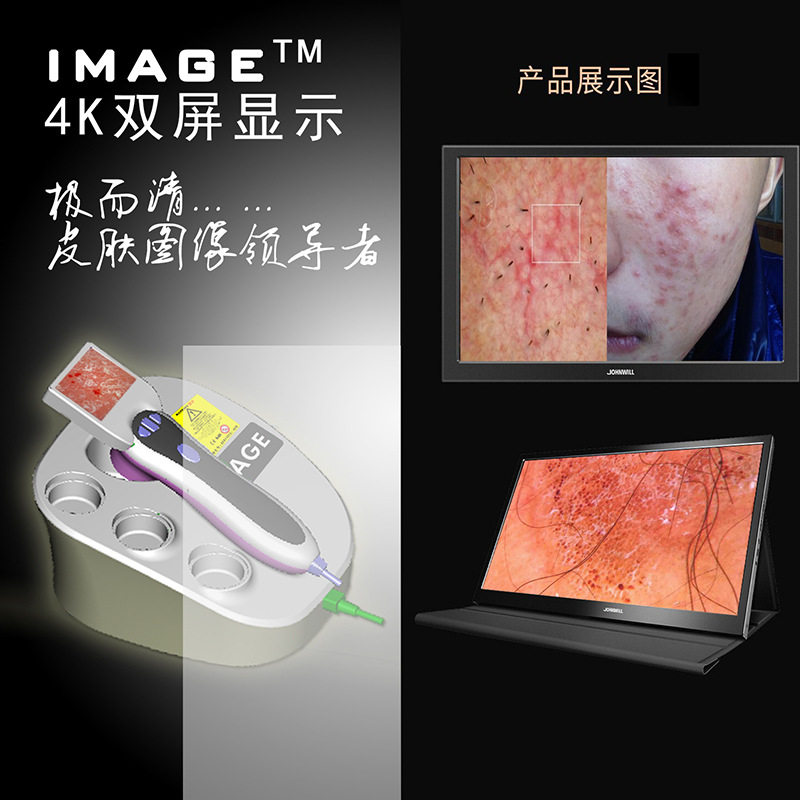 【终身保修】CBS-806 台湾出厂 皮肤检测 测试 分析仪器 可换镜头