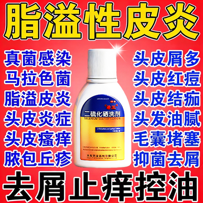 【希王】二硫化硒洗剂2.5%*100g*1瓶/盒