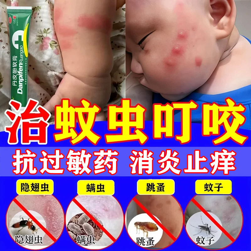 丹皮酚软膏止痒药膏蚊虫叮咬医用级消肿大人儿童专用特药效膏正品