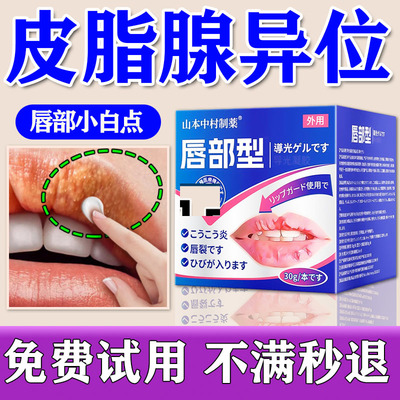 皮脂腺异位症嘴唇白点干裂膏