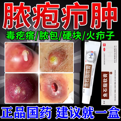 鱼石脂软膏疖肿火疖子脓包身上红肿硬块痘痘毛囊发炎皮脂腺囊肿
